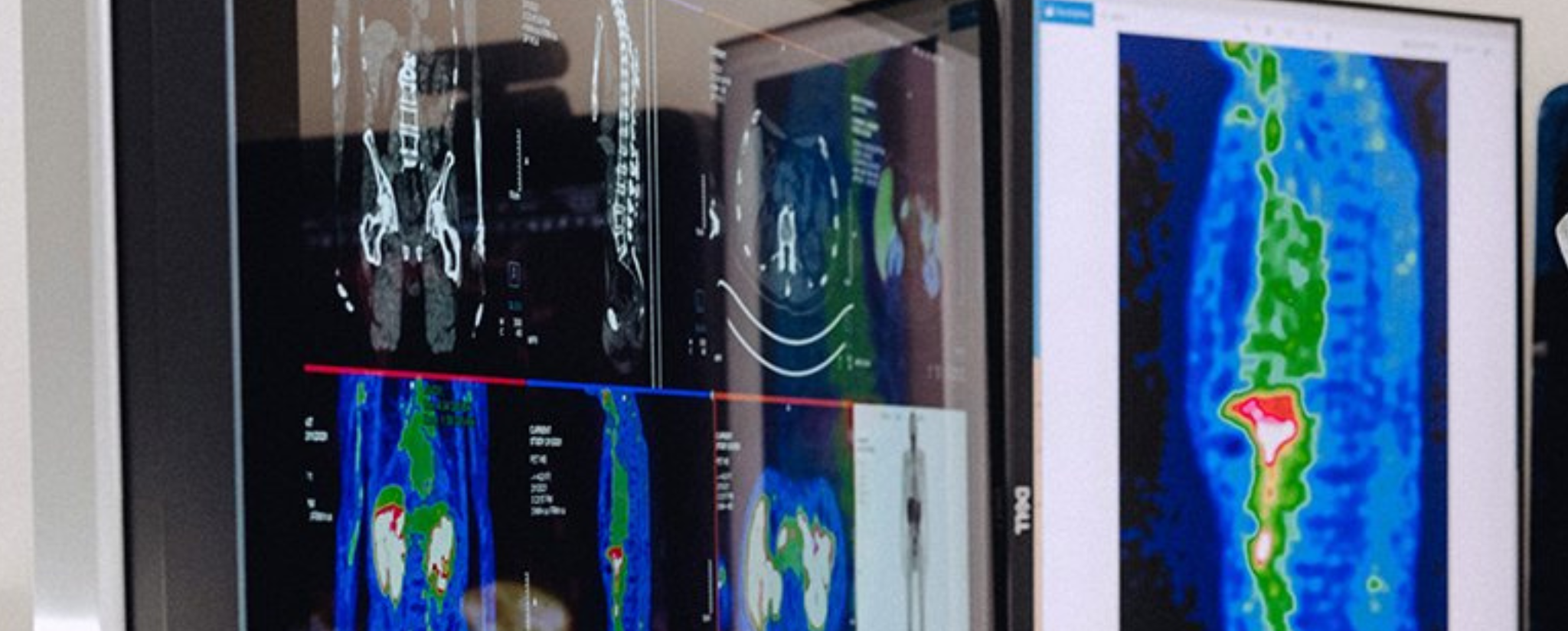 Hoag Hospital Foundation